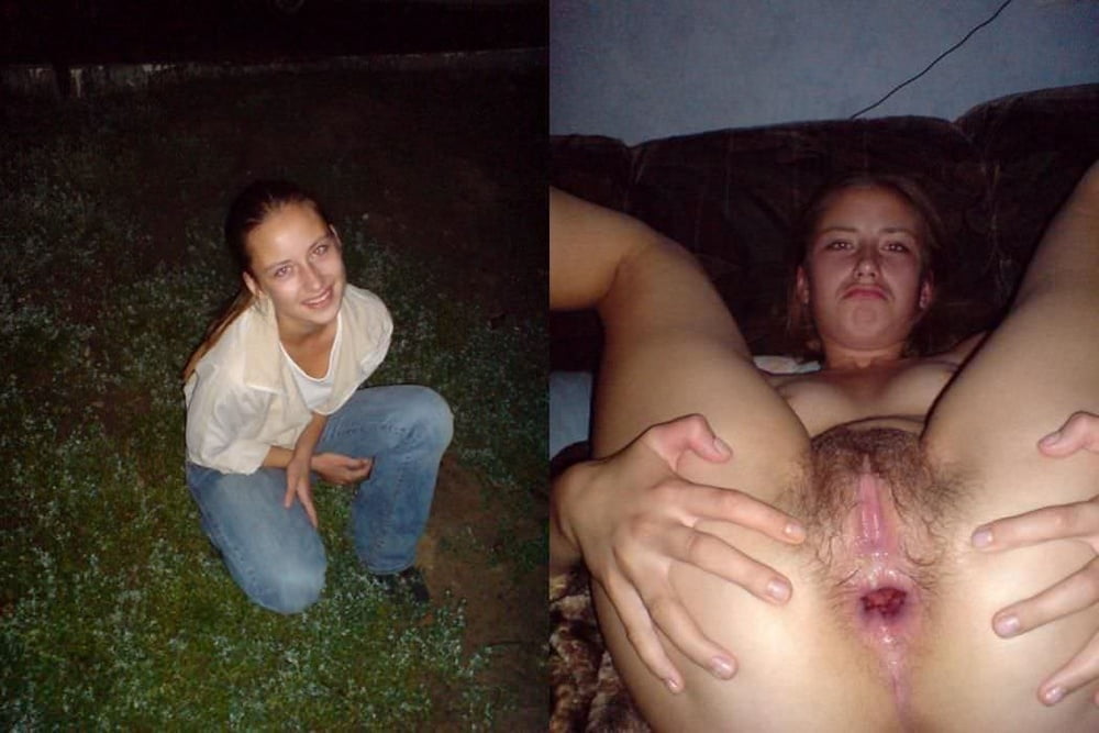 Before And After Anal Sex Porn Pictures Xxx Photos Sex Images