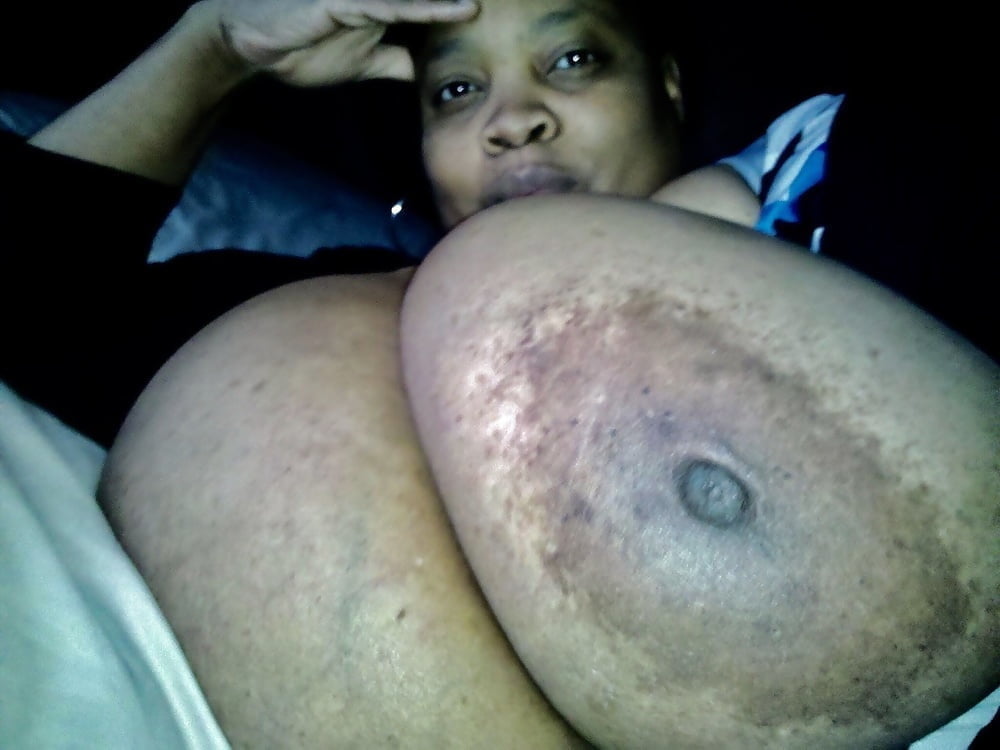Fat Black Tits Porn Pictures, XXX Photos, Sex Images #3884691 Page 6 - PICTOA